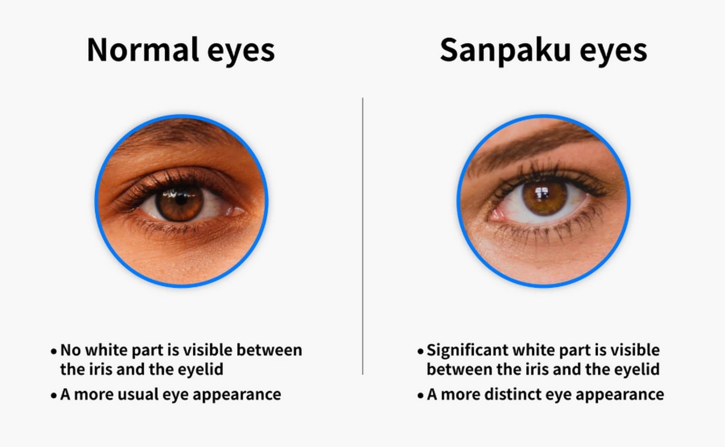 8 Intriguing Aspects Of Sanpaku Eyes To Understand - RTF | Rethinking ...